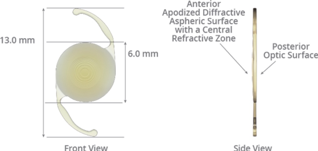 Cataract Surgery Fairfax | Gainesville, VA | What Is A Cataract?